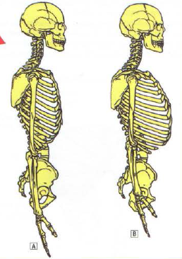 Bench Press And Morphology • Stephane Andre